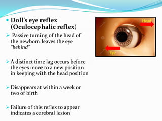 Reflexes present in infants | PPT