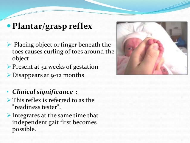 Reflexes present in infants