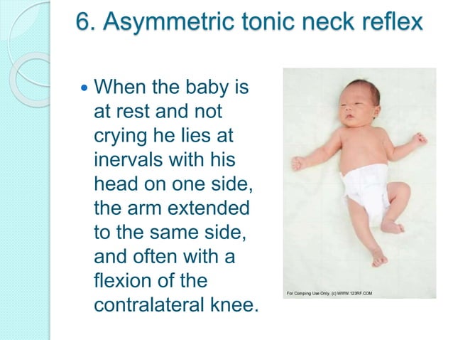 Reflexes present in infants | PPTX | Parenting Babies and Toddlers ...