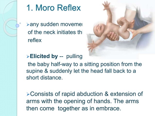 Reflexes present in infants | PPTX | Parenting Babies and Toddlers ...