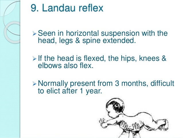 Reflexes present in infants