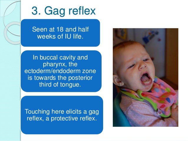 Reflexes present in infants