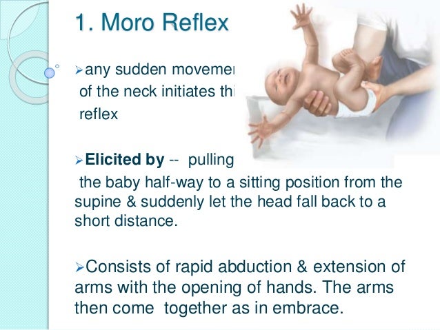 Absence Reflexe Marche Automatique Definition