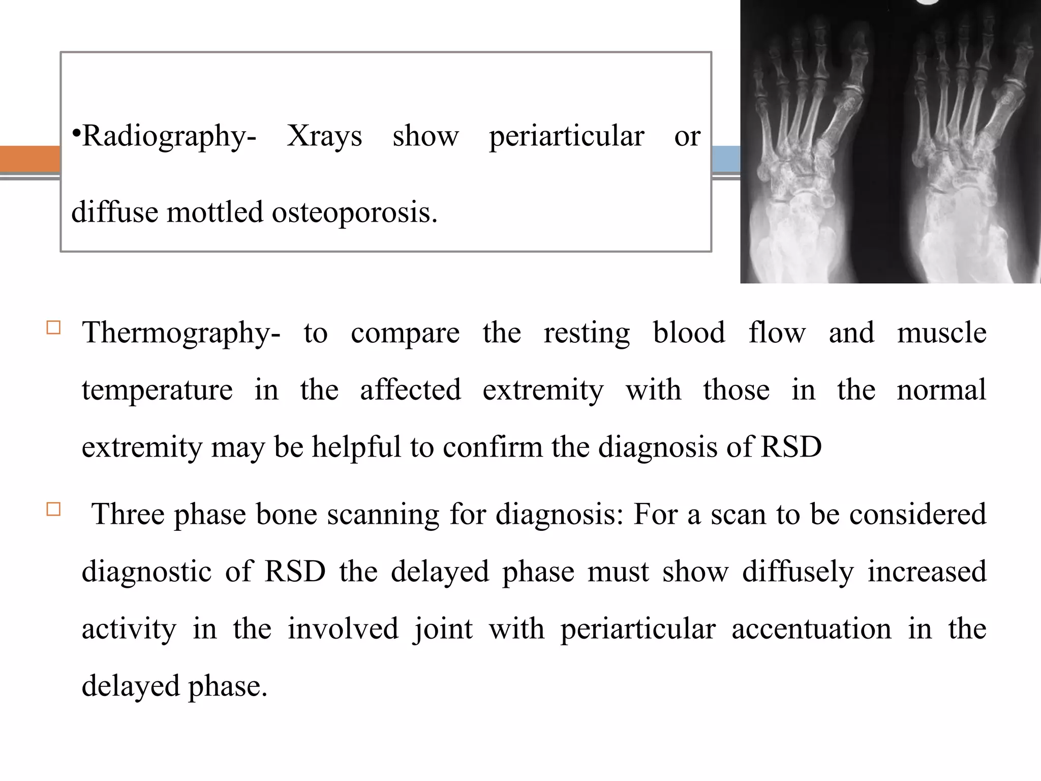 Reflex symapathetic dystrophy | PDF