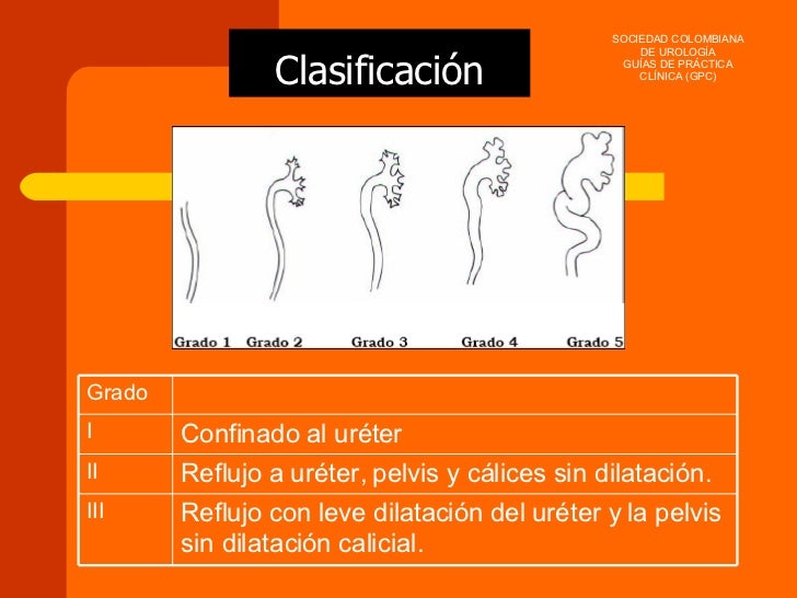 Reflujo Vesicoureteral