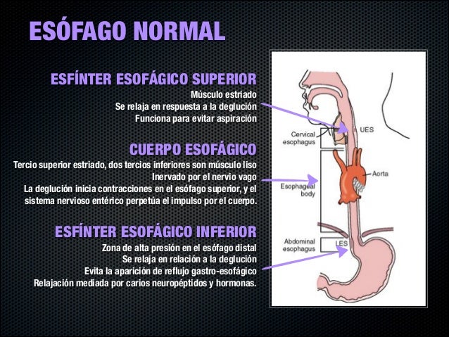 Reflujo gastroesofágico