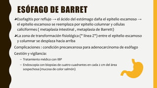 Reflujo gastroesofágico | PPTX