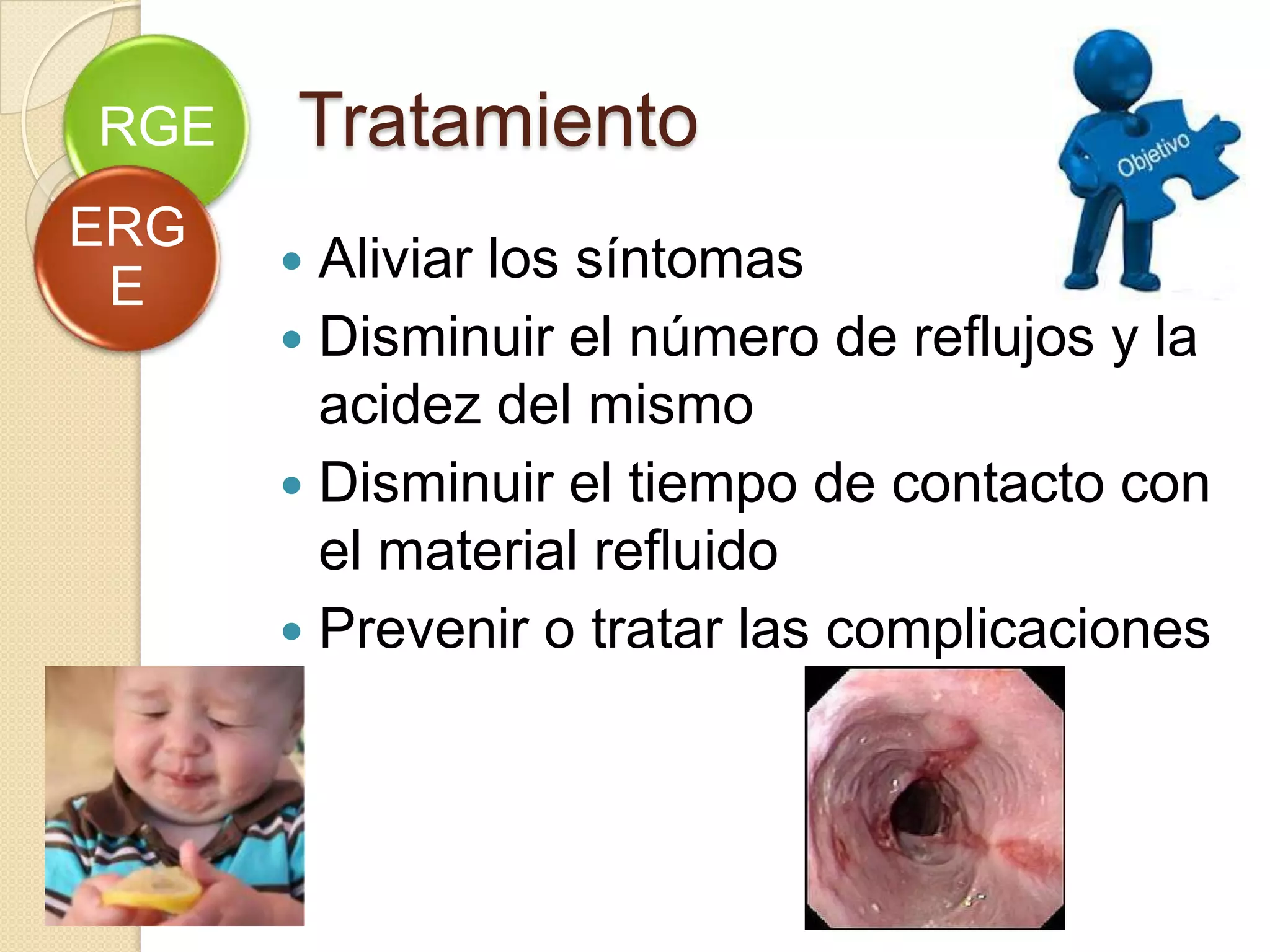 Reflujo gastroesofágico en Pediatría | PPTX