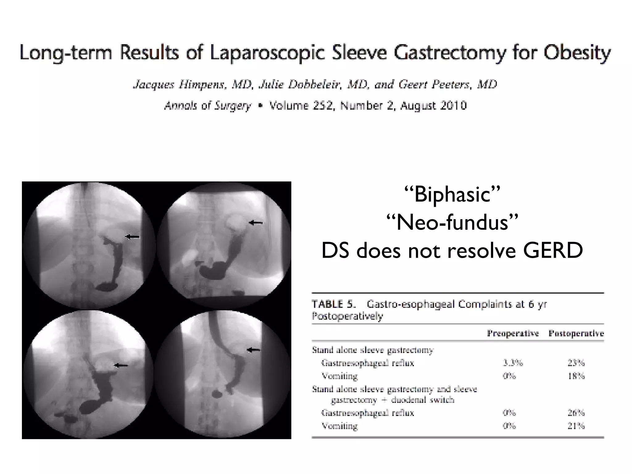 Reflujo ge post manga gástrica | PPT