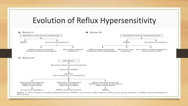 Reflux hypersensitivity | PPTX | Digestive Disorders | Diseases and ...