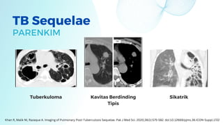 REFRAAT TENTANG TUBERCULOSIS PARU SEQUELE | PDF