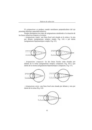 Refraccion ocular iv | PDF