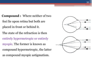 Refraction-II, types of refractive errors | PPTX