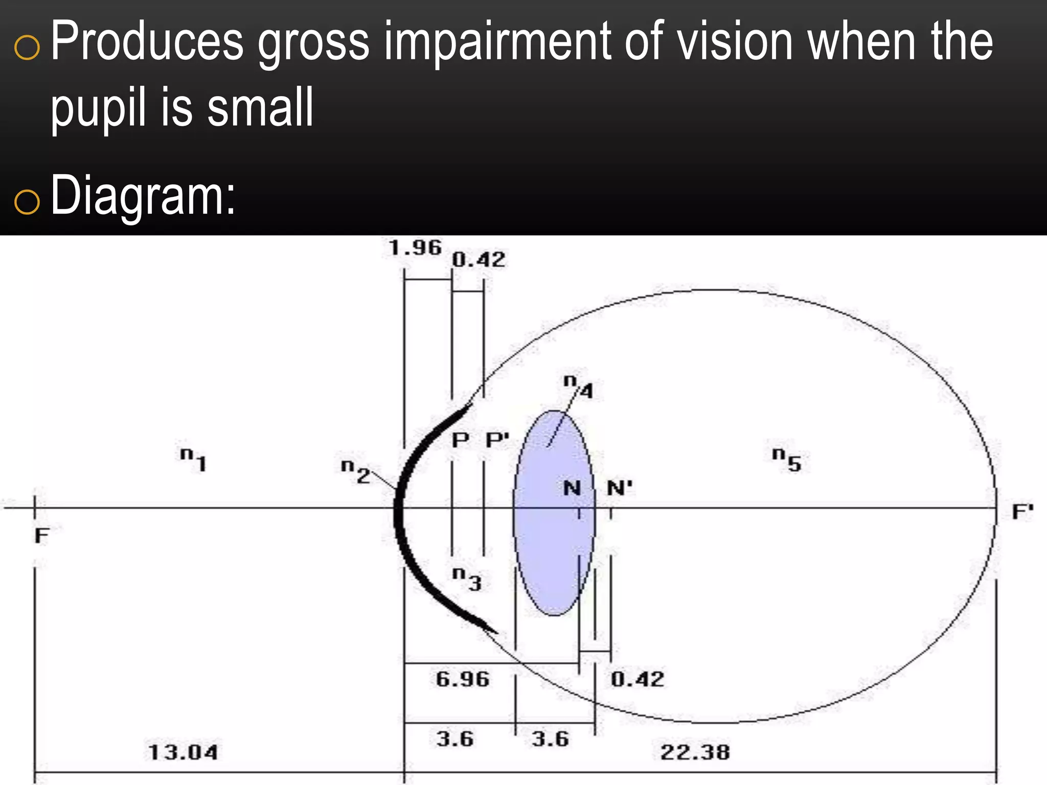 Refraction by the eye, schematic eye, reduced eye By kausar Ali | PPTX