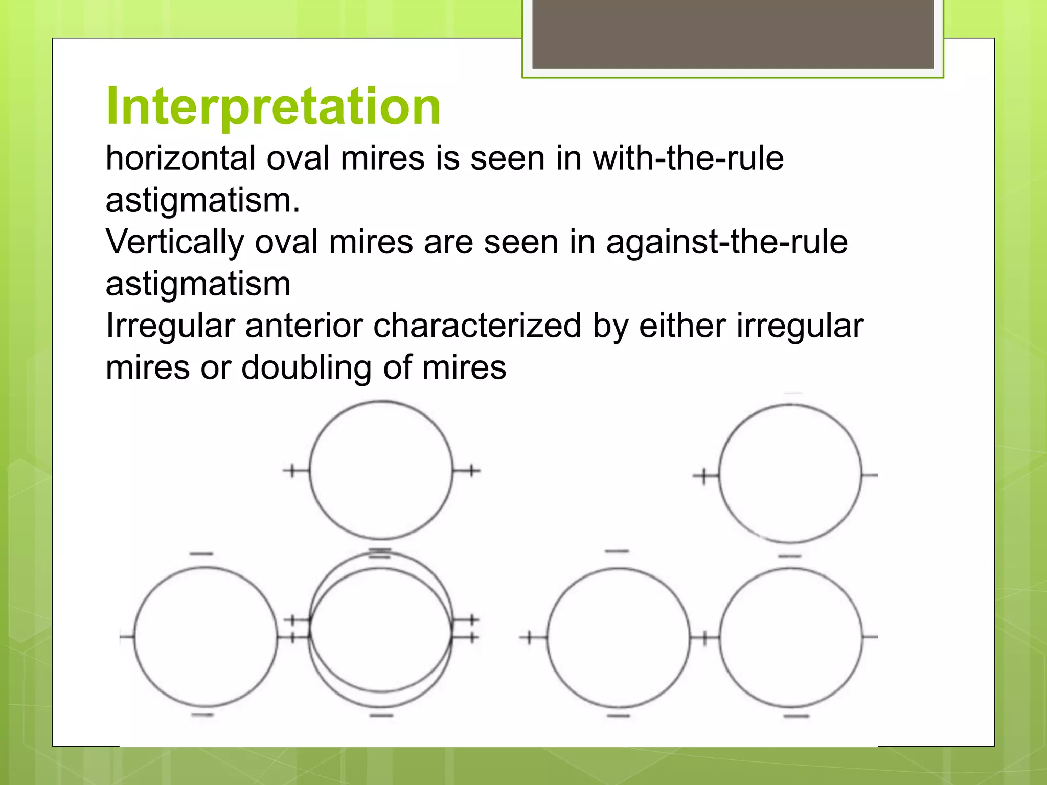 Refraction in different refractive errors and their Management | PPT Refraction in different refractive errors and their Management | PPT