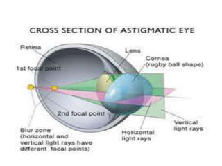 Refraction presentation | PPT