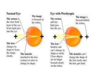 Refraction presentation | PPT
