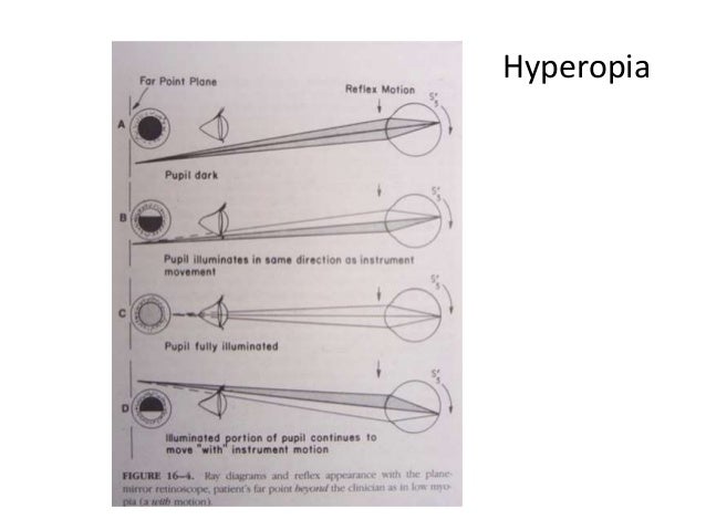 Refraction simplified | PPT