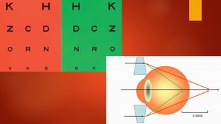 Refraction using a phoropter | PPTX