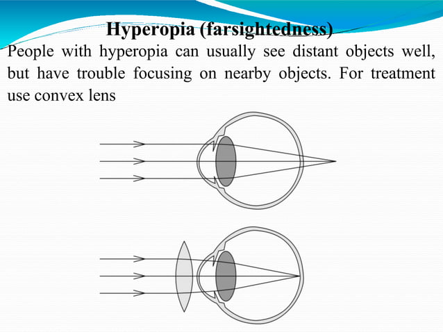 refractiveerror-200625072525.pptx. . | PPT
