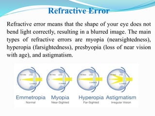 Refractive error | PPT