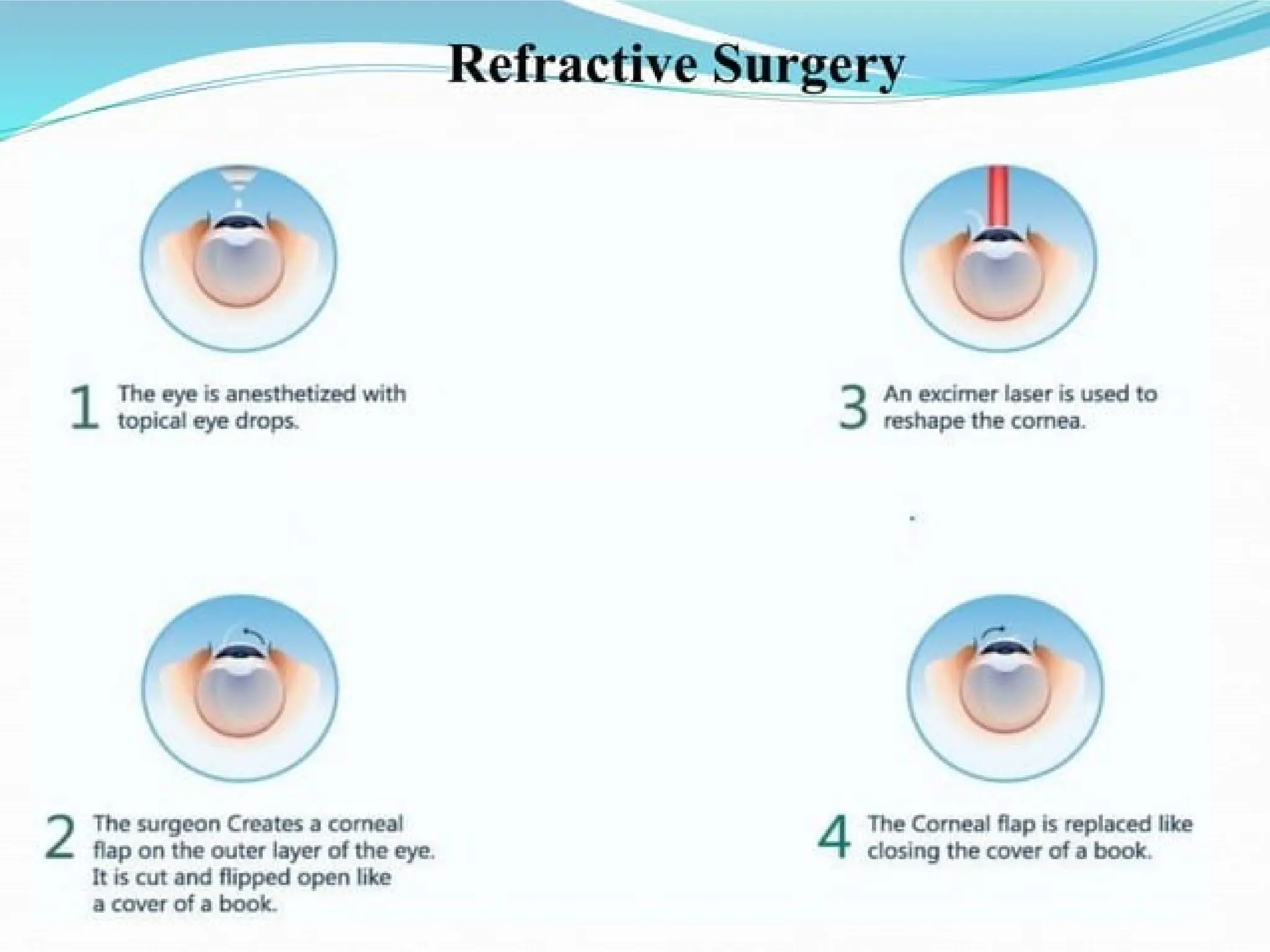 refractive error.ppt definition. Introduction. Etiology | PPT