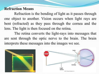 refractive error.ppt definition. Introduction. Etiology | PPT