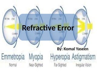 refractive error.pptx . . . . . . . . | PPT