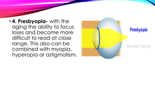 refractive error.pptx reference nursing e | PPT