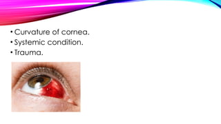 refractive error.pptx reference nursing e | PPT