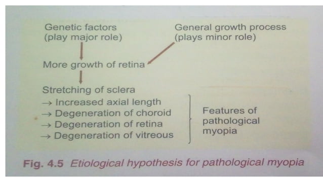 Refractive error (Myopia )by Upendra pal .pdf