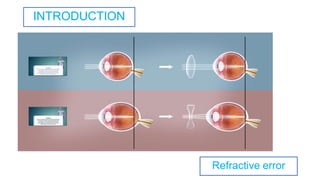 Refractive errors | PPTX