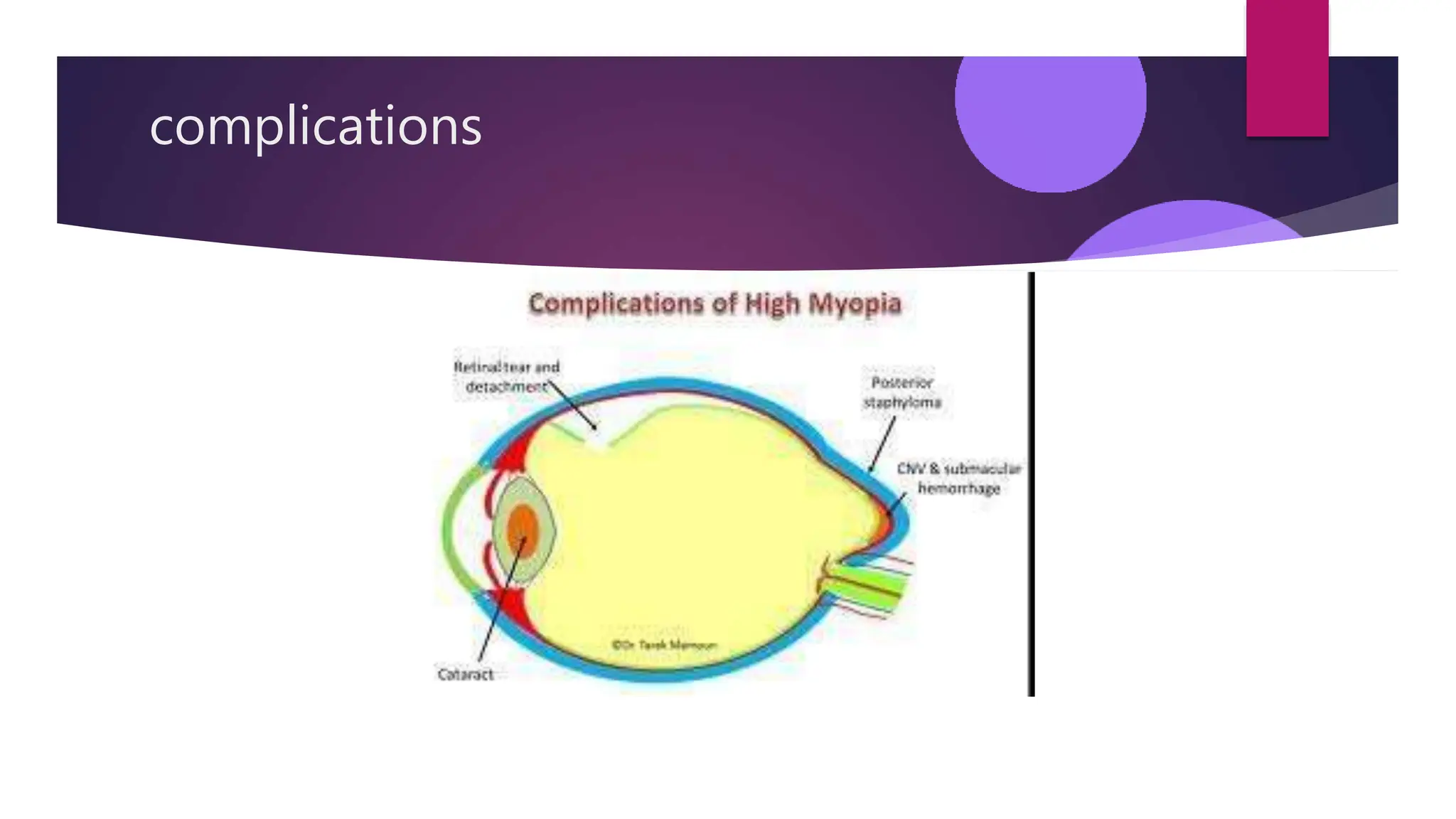 REFRACTIVE ERRORS and their diagnosis.pptx