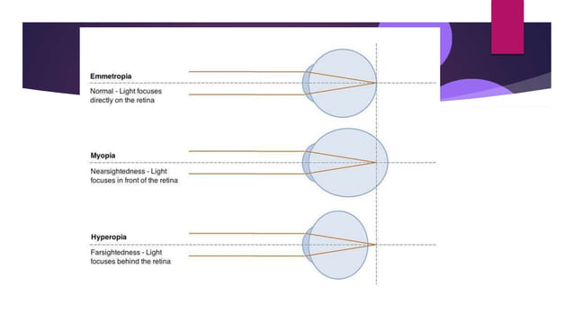 REFRACTIVE ERRORS and their diagnosis.pptx