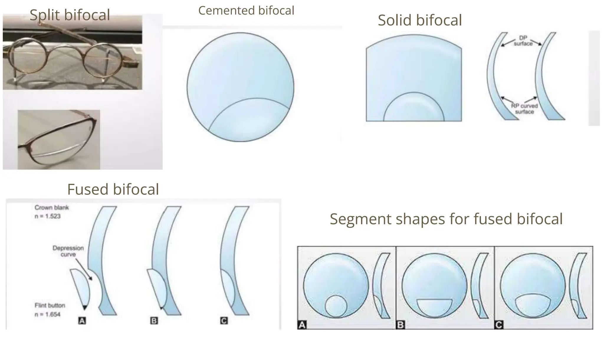 REFRACTIVE ERRORS and its management (2).pptx