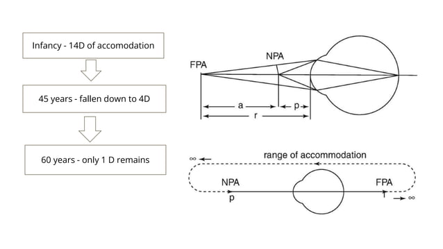 REFRACTIVE ERRORS and its management (2).pptx