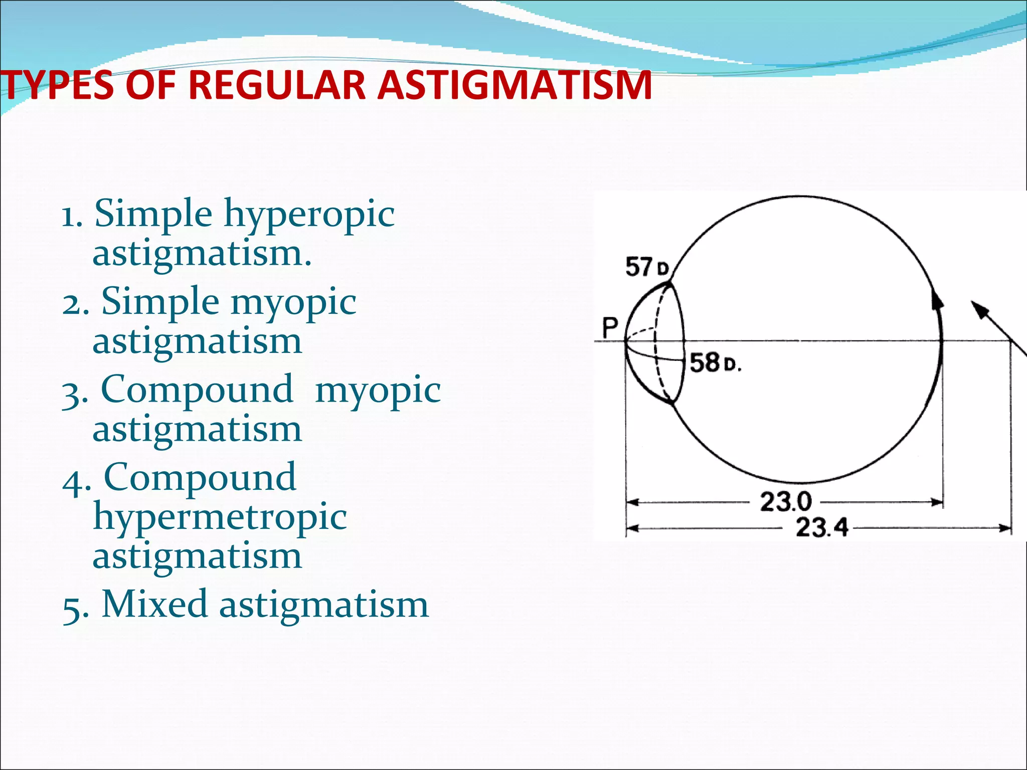 Ophthalmology 5th year, 4th lecture (Dr. Tara) | PPT