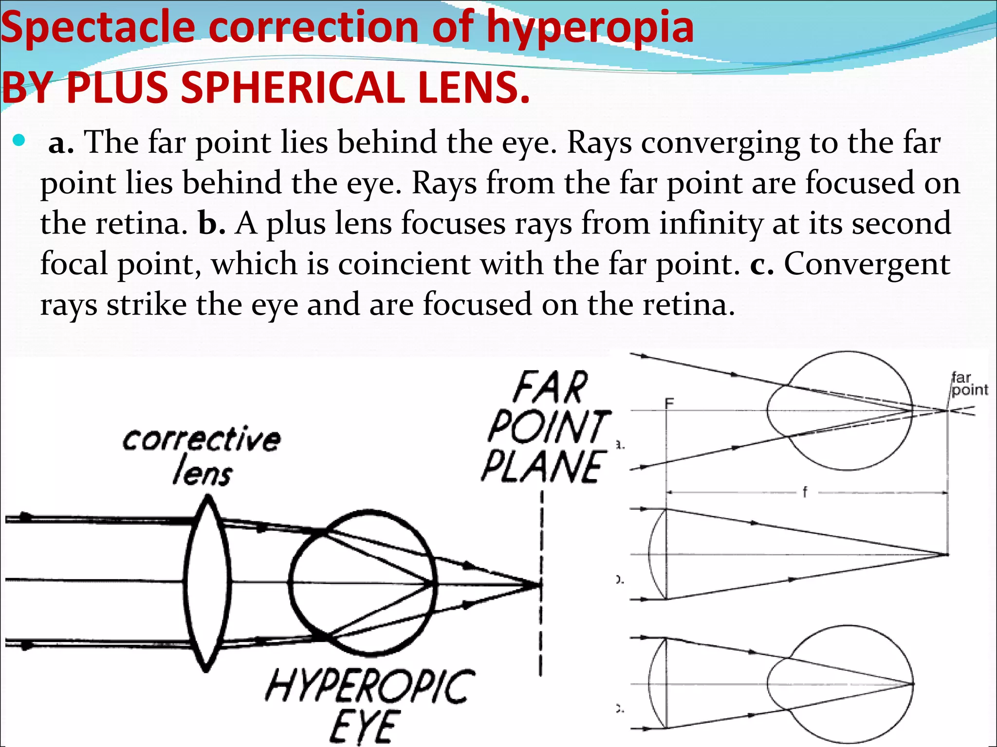 Ophthalmology 5th year, 4th lecture (Dr. Tara) | PPT