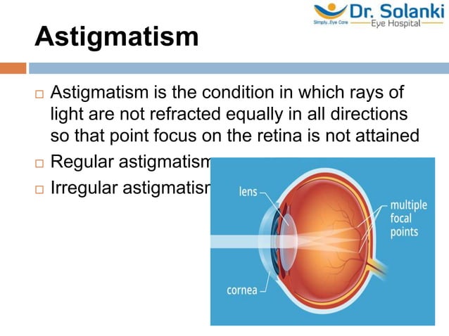 Refractive errors and how to correct them | PPTX