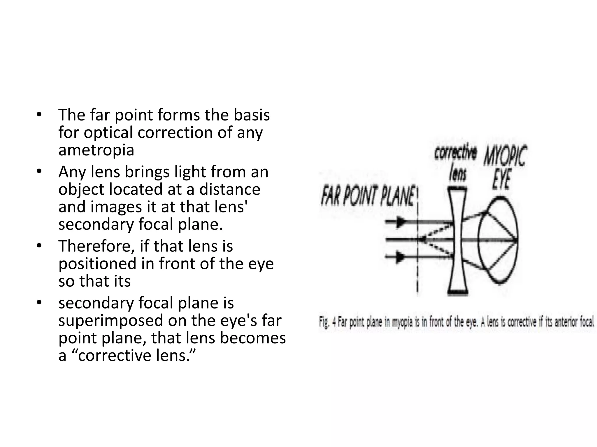 Refractive errors correction | PPTX