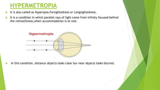Refractive errors & their management | PPTX