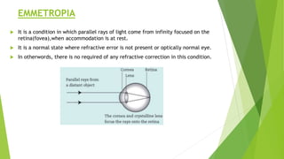 Refractive errors & their management | PPTX