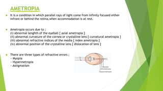 Refractive errors & their management | PPTX