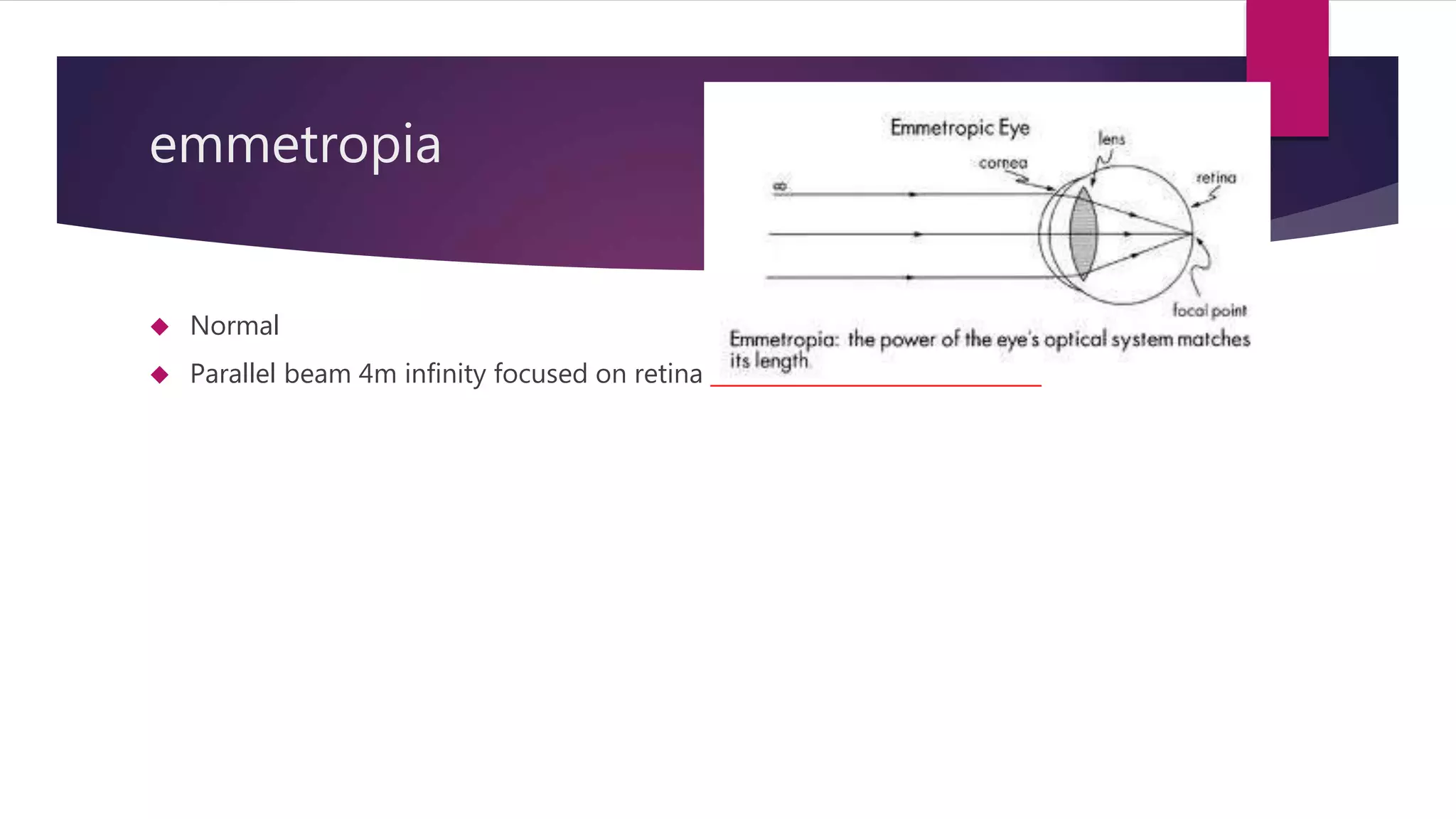 Refractive errors of eye ophthalmology astigmatism hypermetropia myopia ...