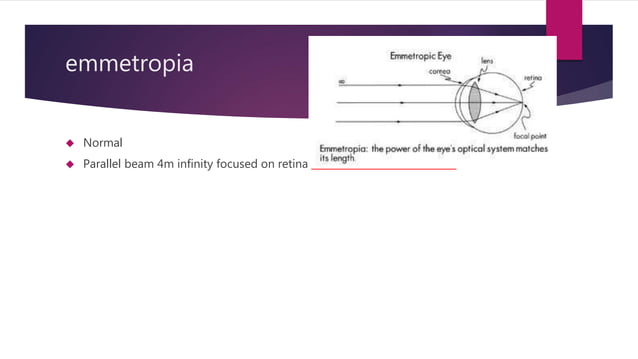 Refractive errors of eye ophthalmology astigmatism hypermetropia myopia medicine | PPTX