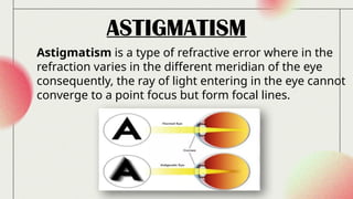Refractive errors of eye MYOPIA HYPERMETROPIA.pptx