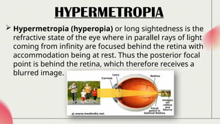 Refractive errors of eye MYOPIA HYPERMETROPIA.pptx