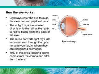 Refractive lens exchange 2017 | ODP