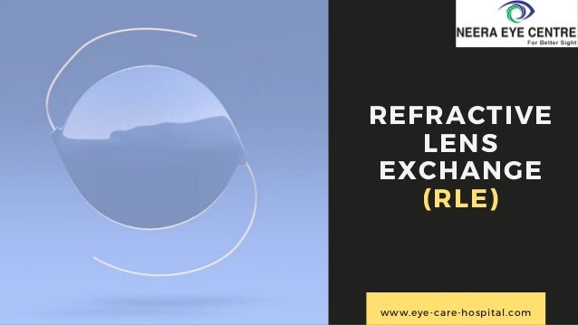 Refractive lens exchange