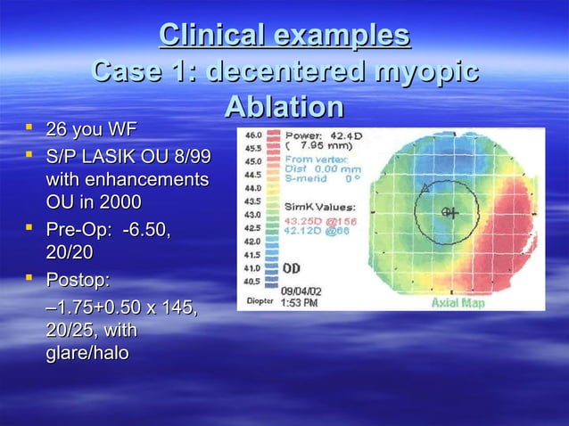 Refractive optics | PPT